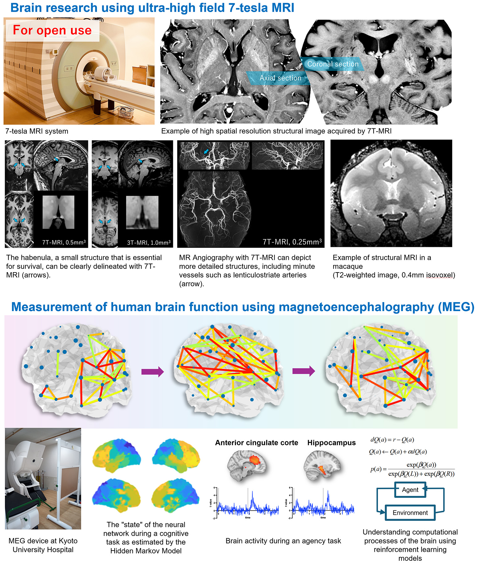 Human Brain Research Center | Graduate School of Medicine and Faculty ...