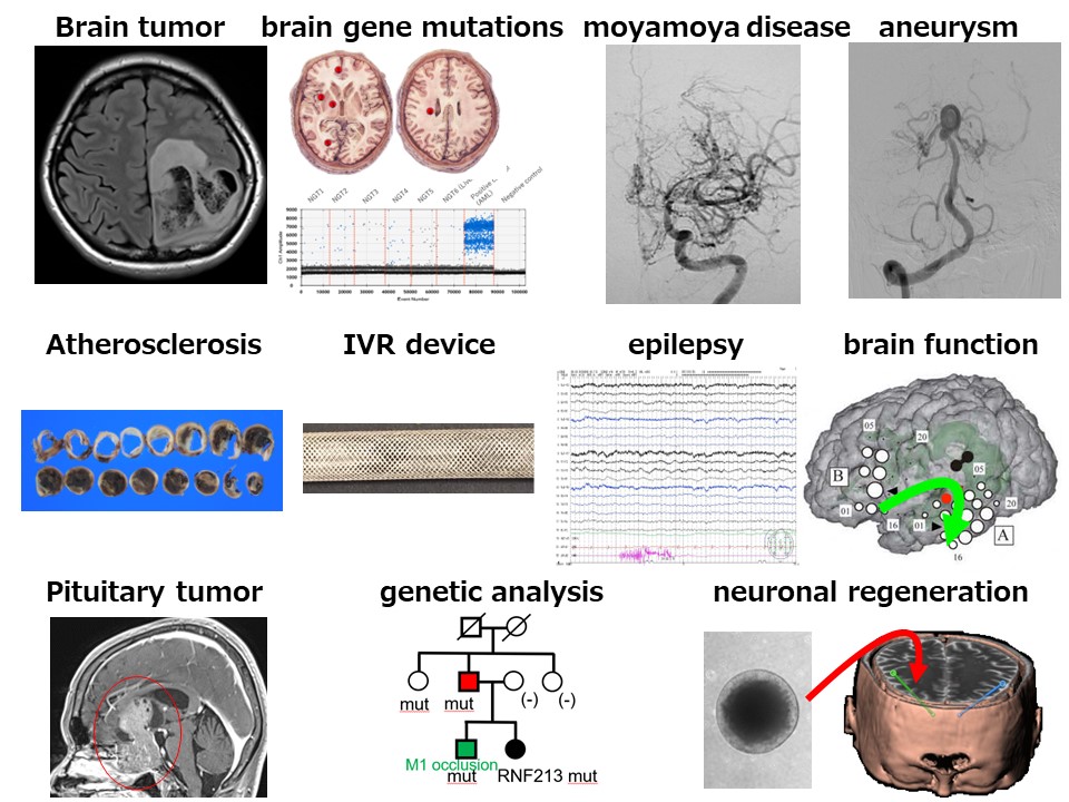 Neurosurgery | Graduate School of Medicine and Faculty of Medicine ...